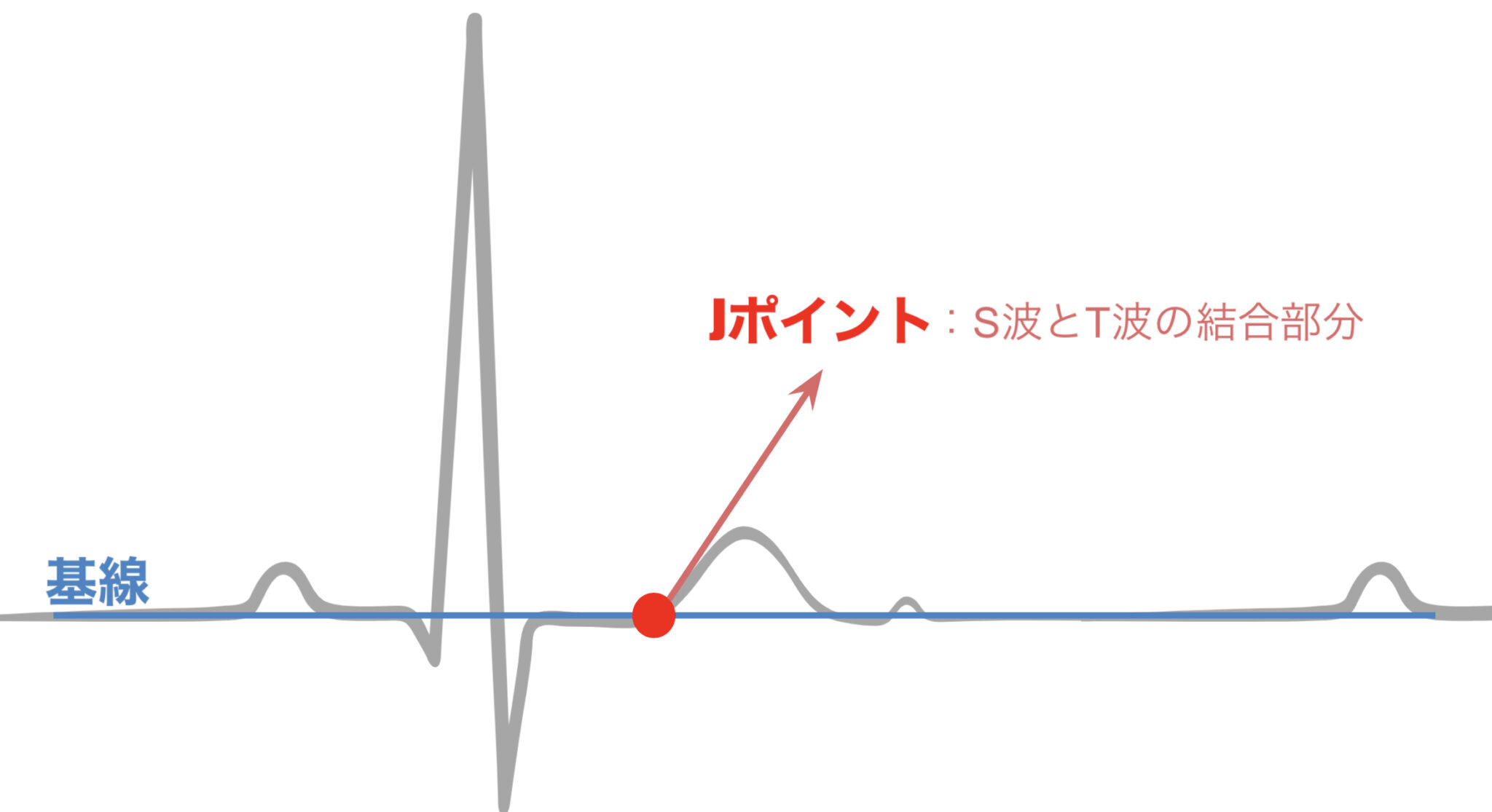 ST上昇・低下を示す心電図“Jポイント”について！心電図のわかりやすい見方！ | 救急救命士キャリアップデート
